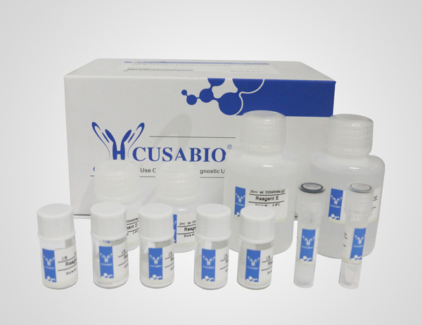 CUSABIO Exosome Isolation Kit, A Great Exosome Research Tool
